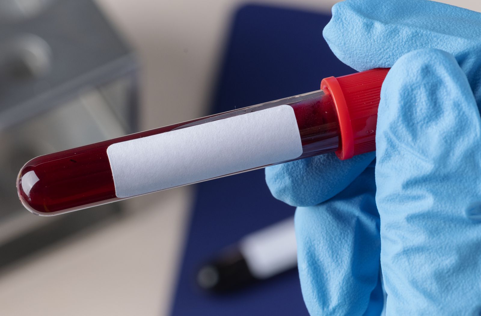 Headache tests for identifying dangerous headaches